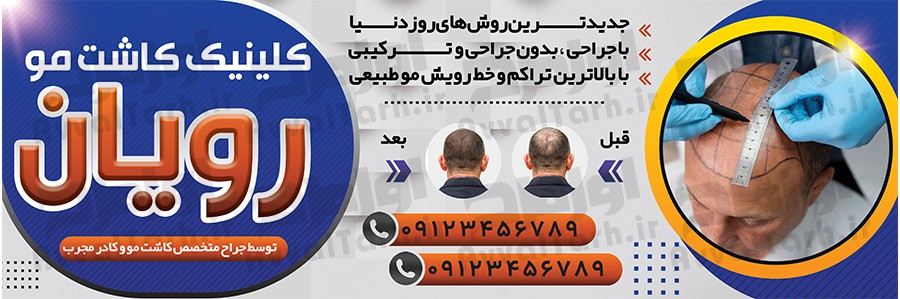 بنر لایه باز کلینیک کاشت مو اول طرح